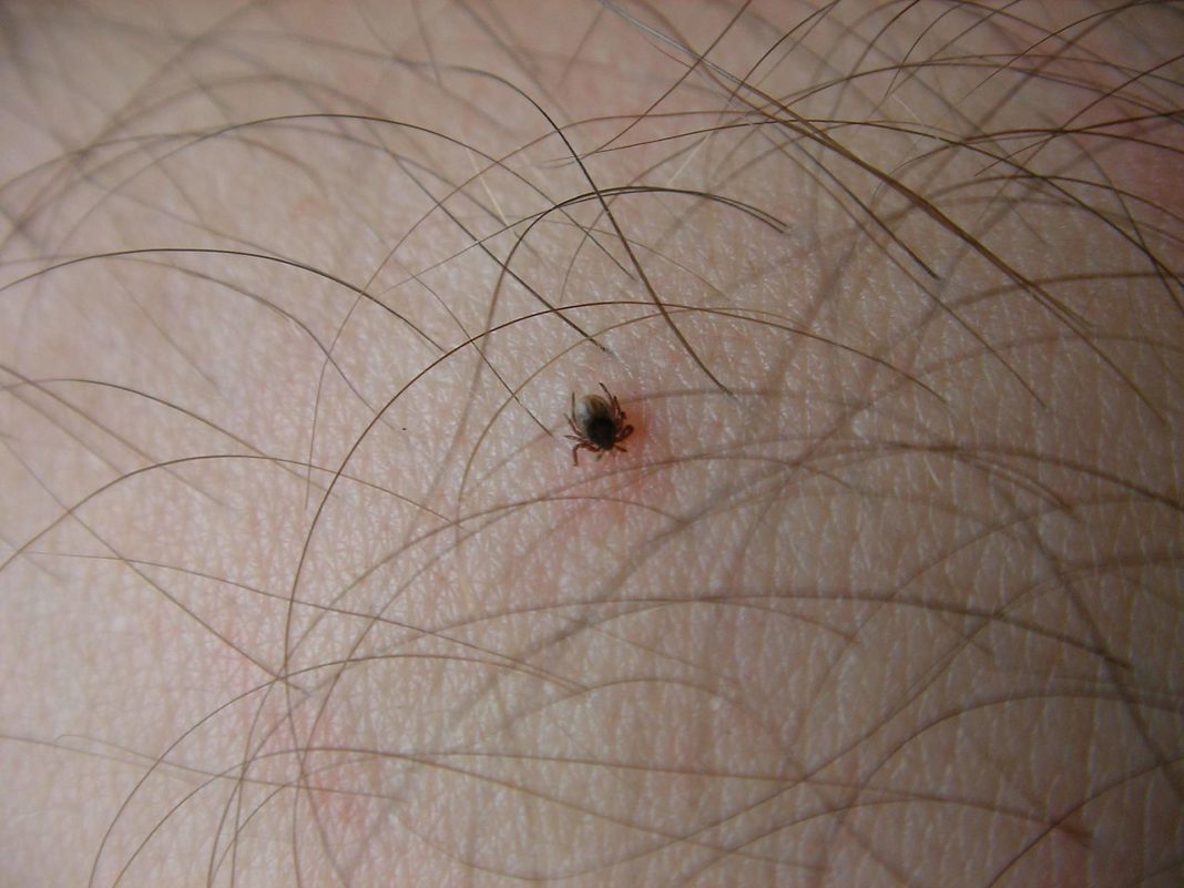 Petite tique… grosse maladie…Lyme | ChalonTV